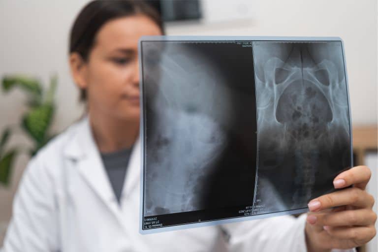 Radiografias | Servicios Medicos Lima Norte